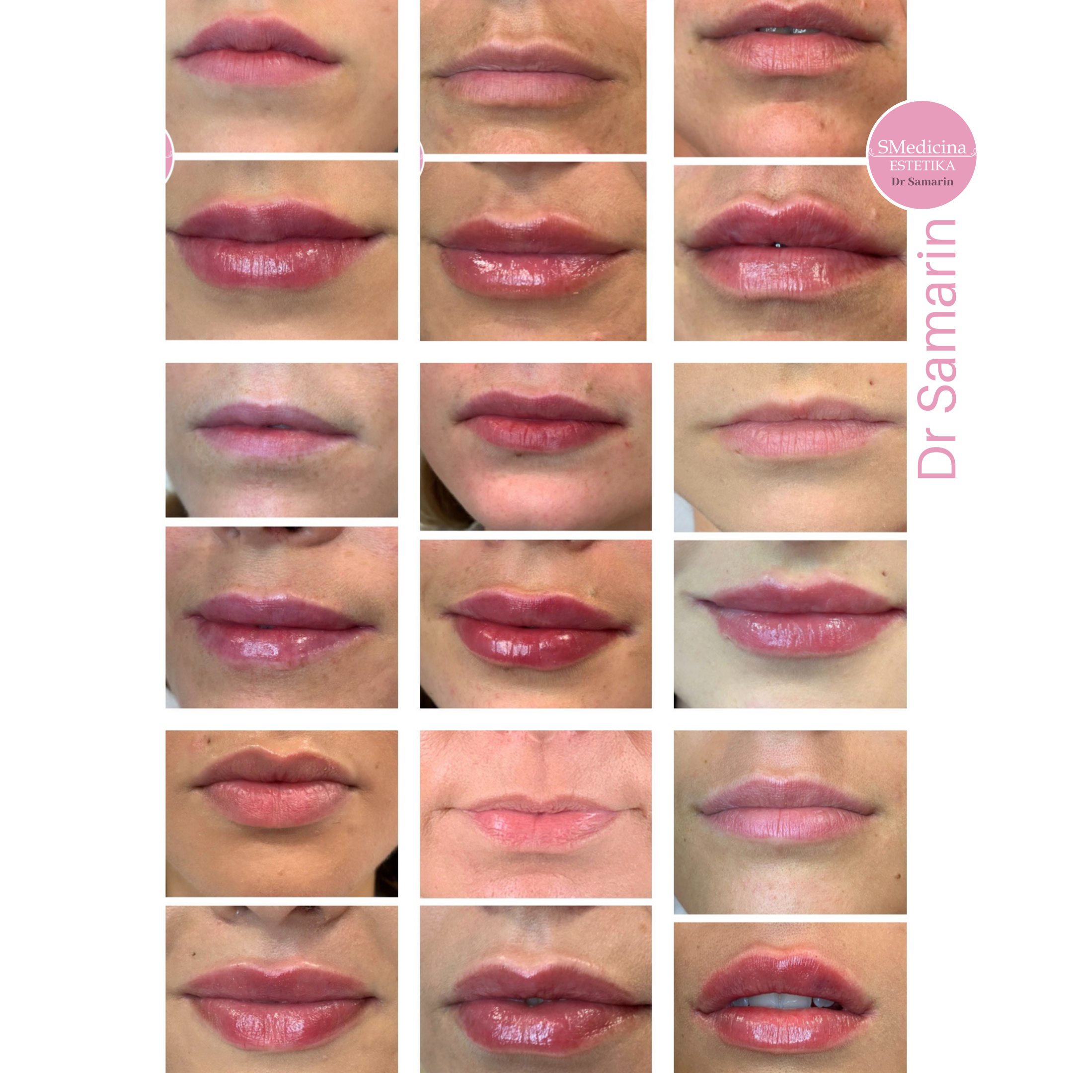 Novice | Estetika SMedicina